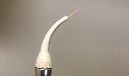 Lasers in Dentistry