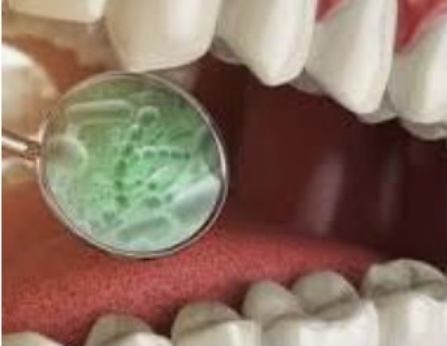 Oral Microbiome... What is it?