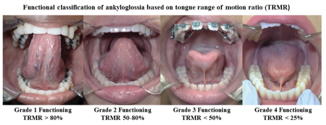 Myofunctional Therapy Crash Course